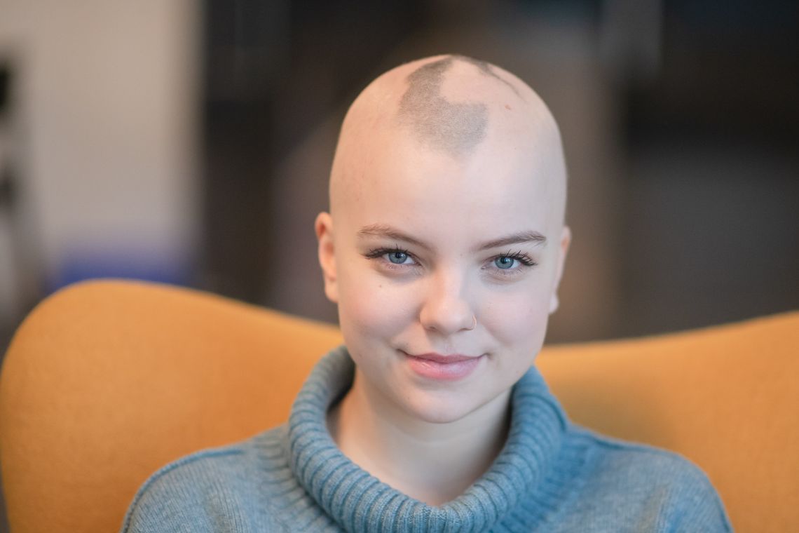 El cabello después del cáncer